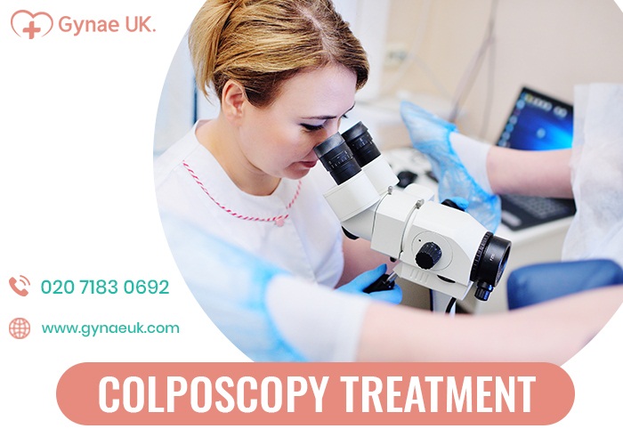 Private Colposcopy London | Colposcopy | Gynae UK